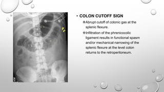 ACUTE PANCREATITIS and surgical management | PPTX