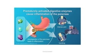Acute pancreatitis causes and treatment. | PPTX