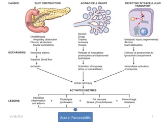 Acute pancreatitis and their management .pptx