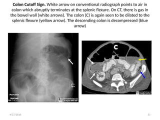 Acute pancreatitis enhanced learning motive | PPTX