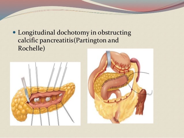 pancreatitis anoop k r
