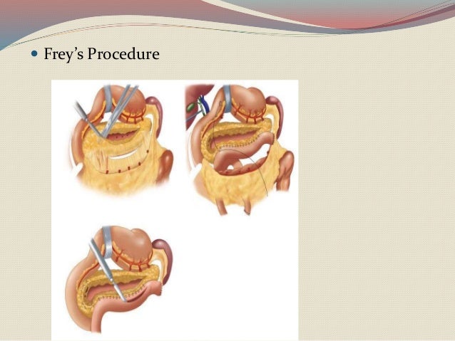 pancreatitis anoop k r