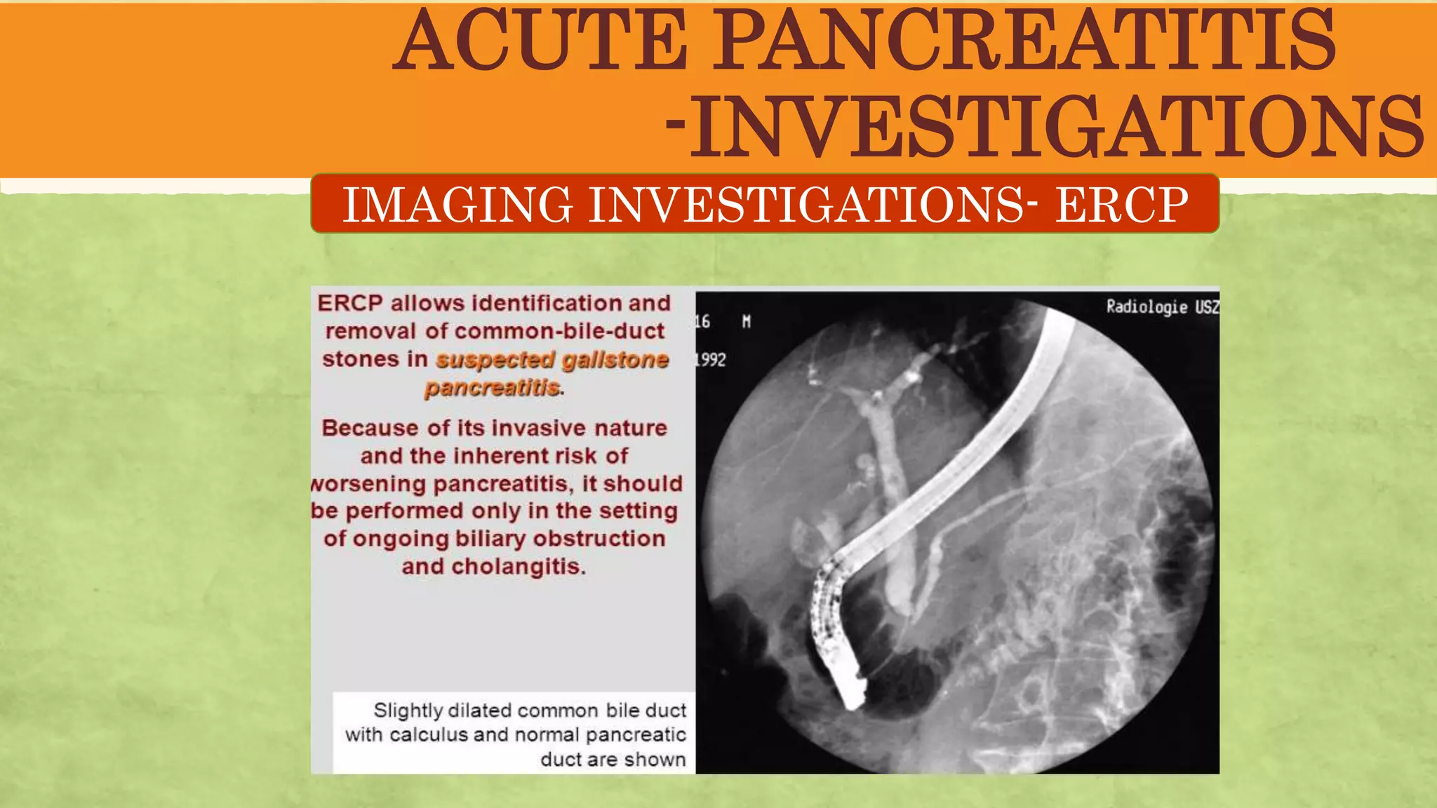 Acute pancreatitis / Epigastric pain | PPTX