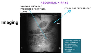 Acute pancreatitis : Definition, Diagnosis and Management | PDF | Digestive Disorders | Diseases ...