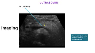 Acute pancreatitis : Definition, Diagnosis and Management | PDF ...