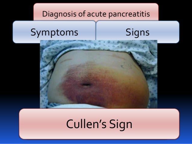 Acute pancreatitis basics