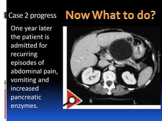 Acute pancreatitis case discussion | PPSX