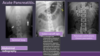 acute pancreatitis Dr Maha Hafez 2020.pdf