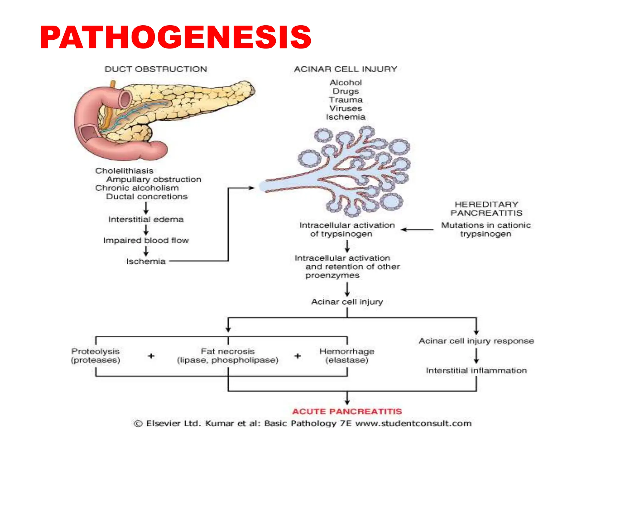 Acute Pancreatitis It's Management and Complications .pptx | Blood ...