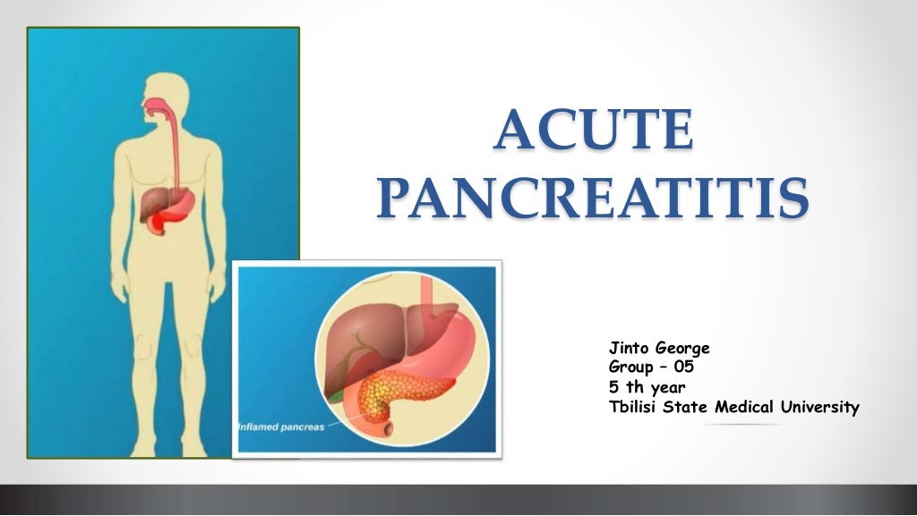 Acute Pancreatitis