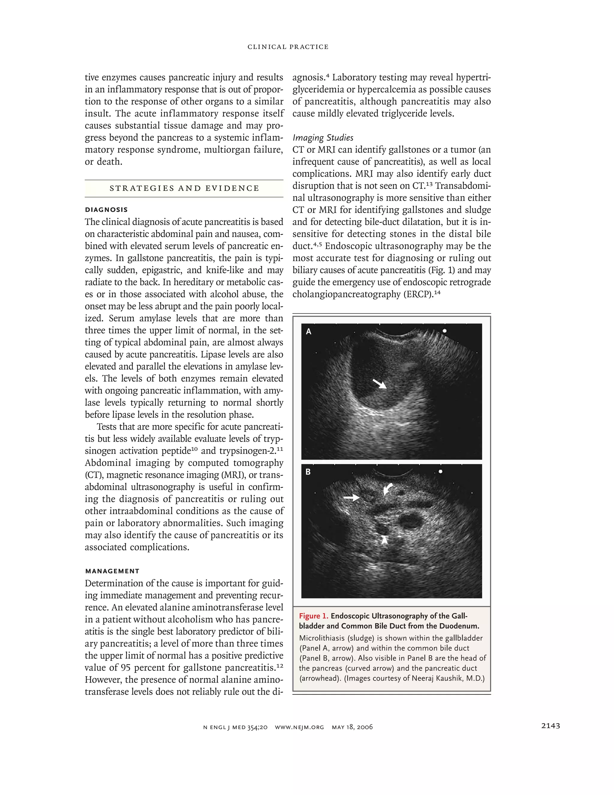 Acute pancreatitis nejm 2006 | PDF