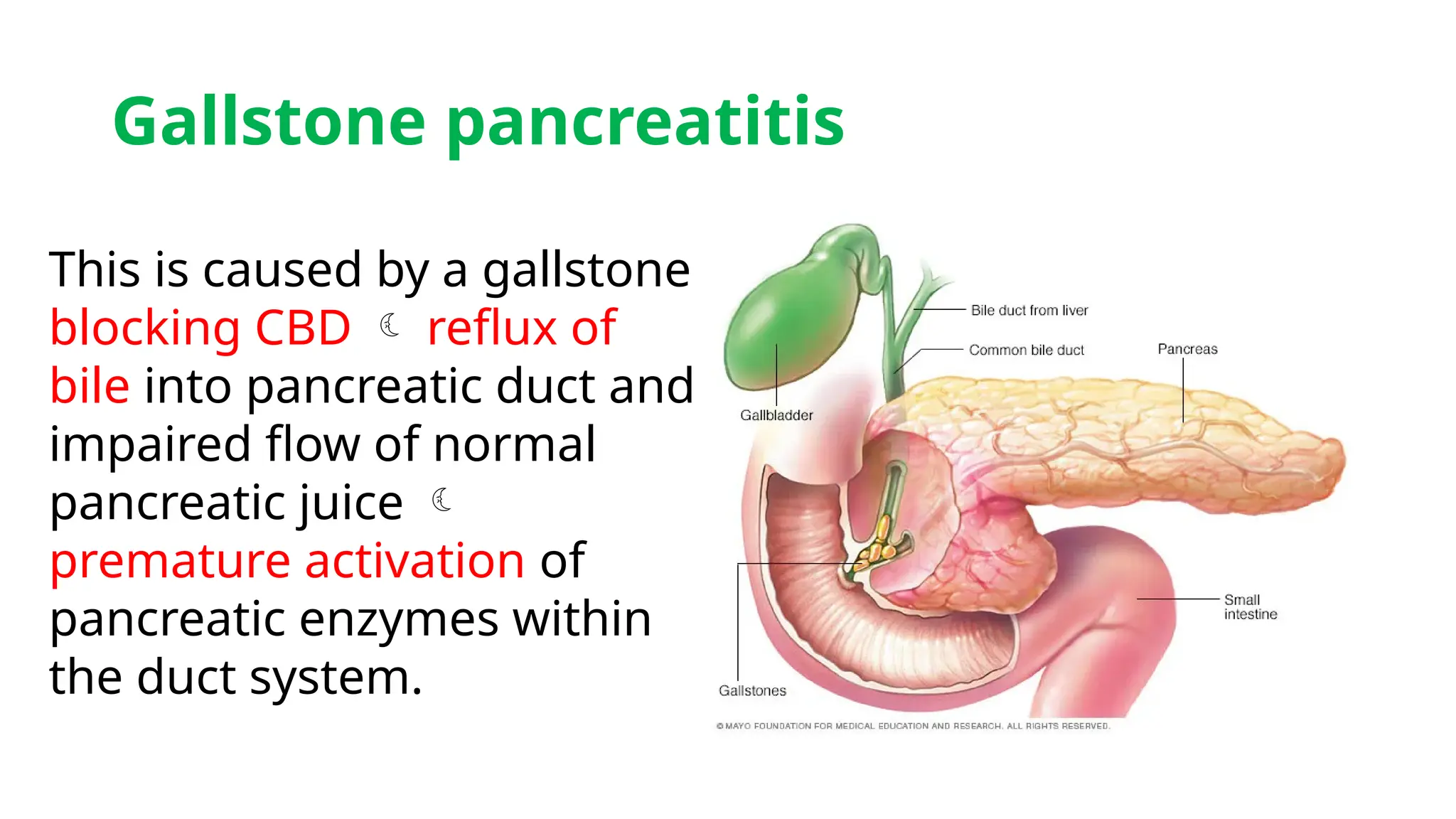 updated guidelies of acute pancreatitis .pptx