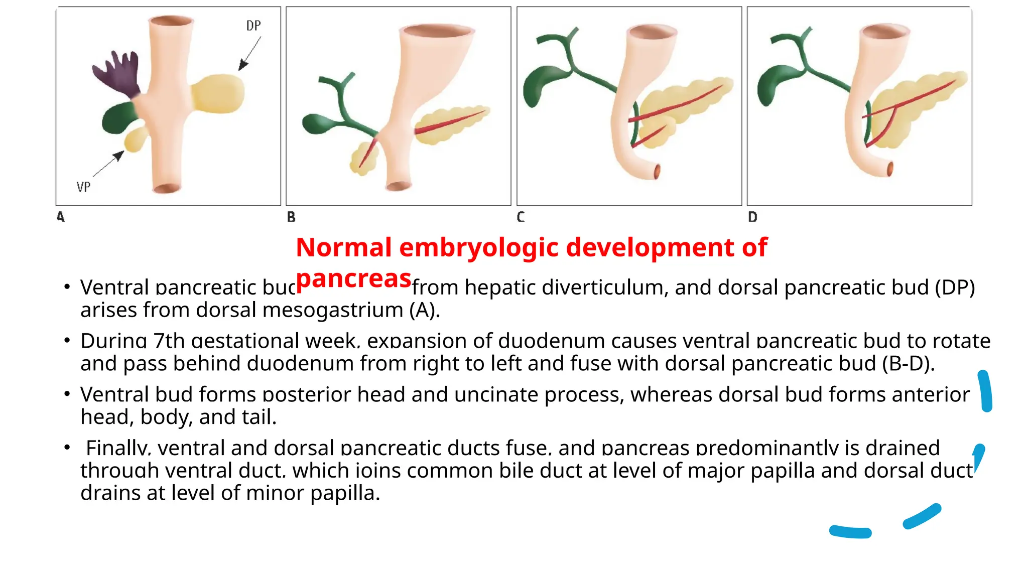 updated guidelies of acute pancreatitis .pptx