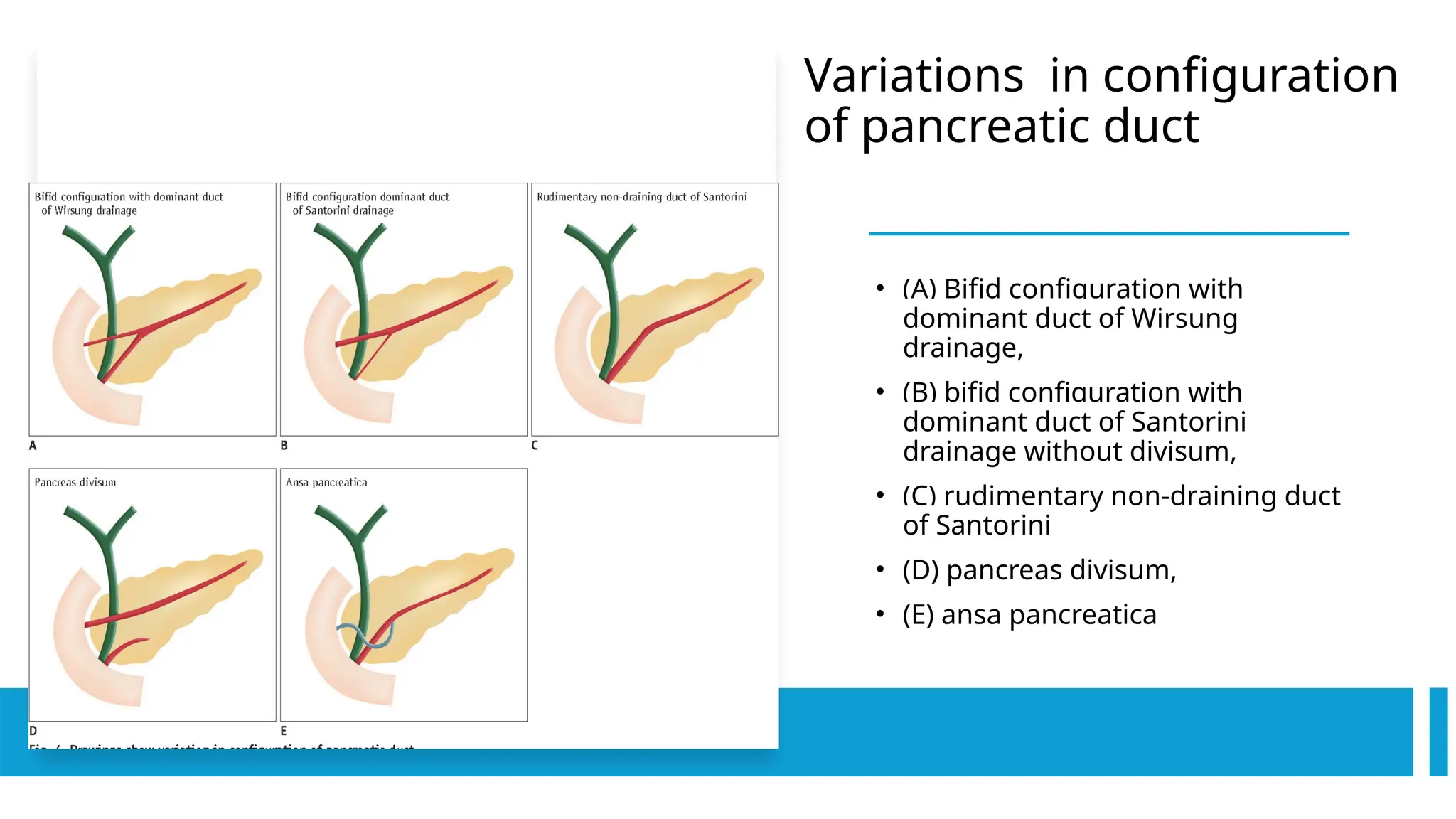updated guidelies of acute pancreatitis .pptx