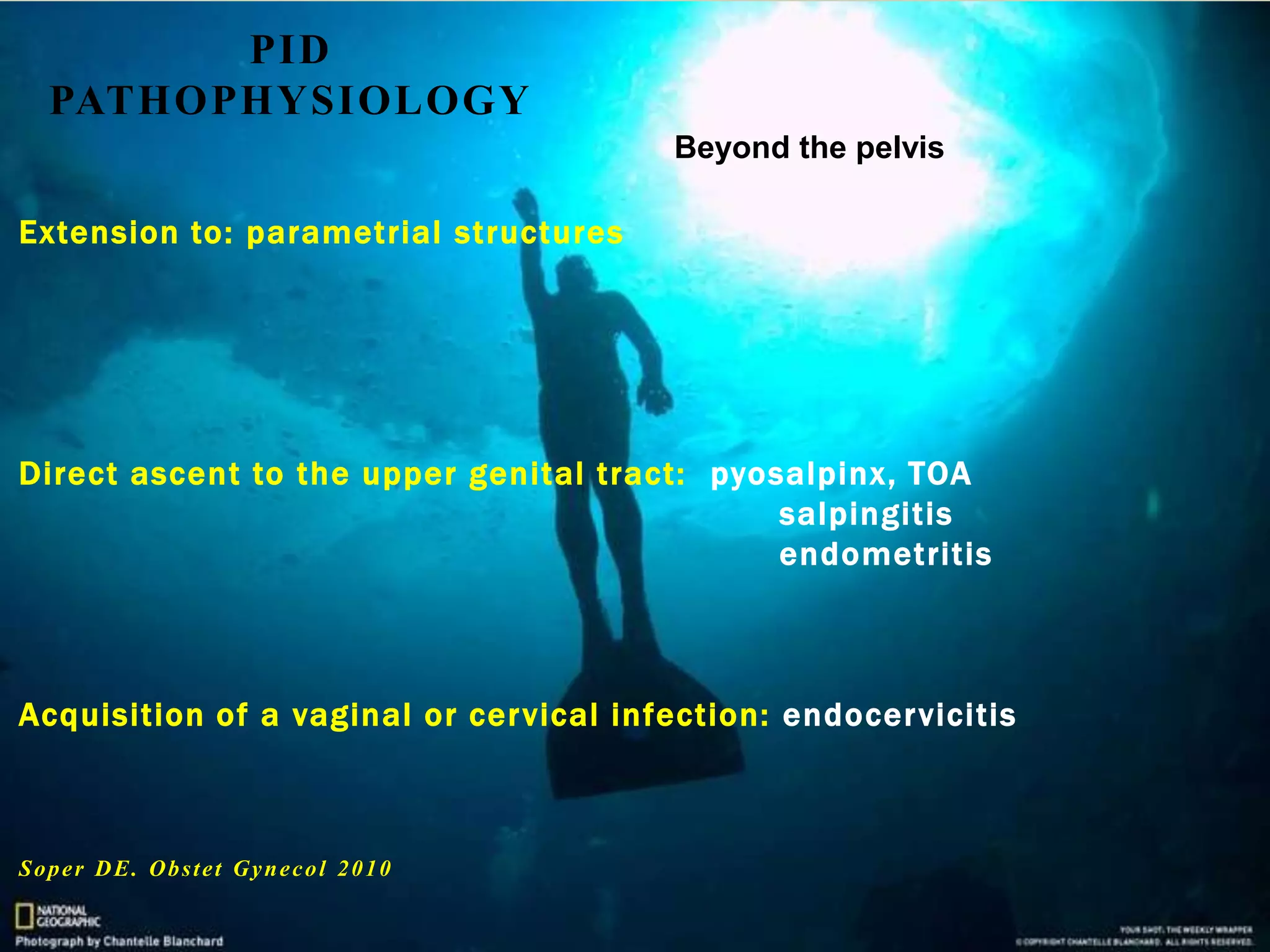 Acute female pelvic infection . ESUR Congress. | PPTX