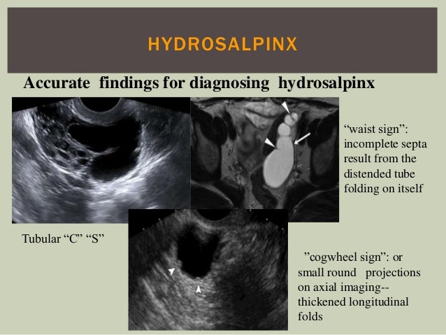 Acute female pelvic infection . ESUR Congress.