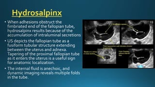 acute pelvic pain RADIOLOGY LECTURE.pptx