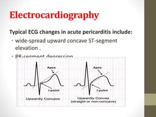 Acute Pericarditis.pptx