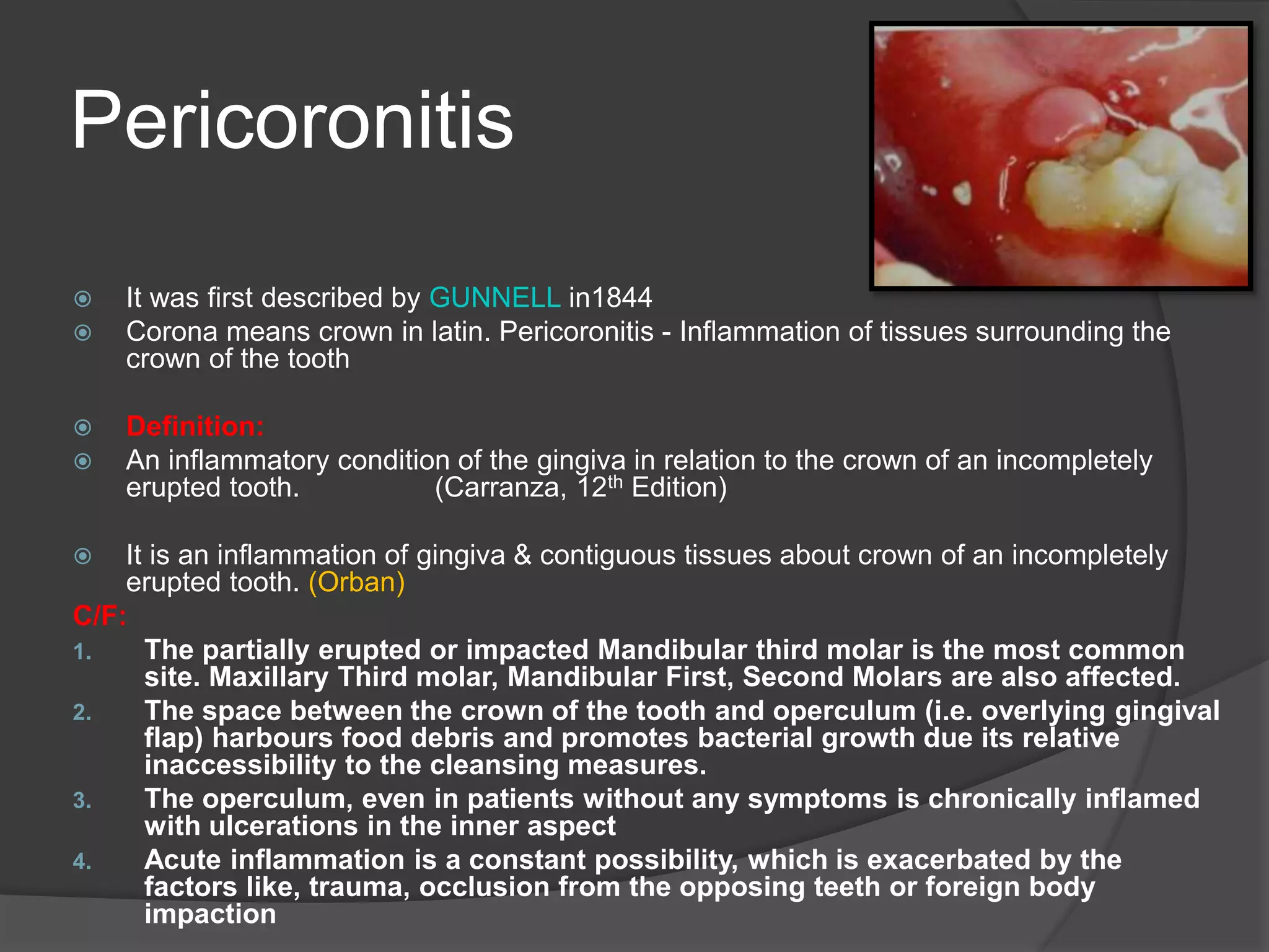Acute periodontal Infections | PPTX