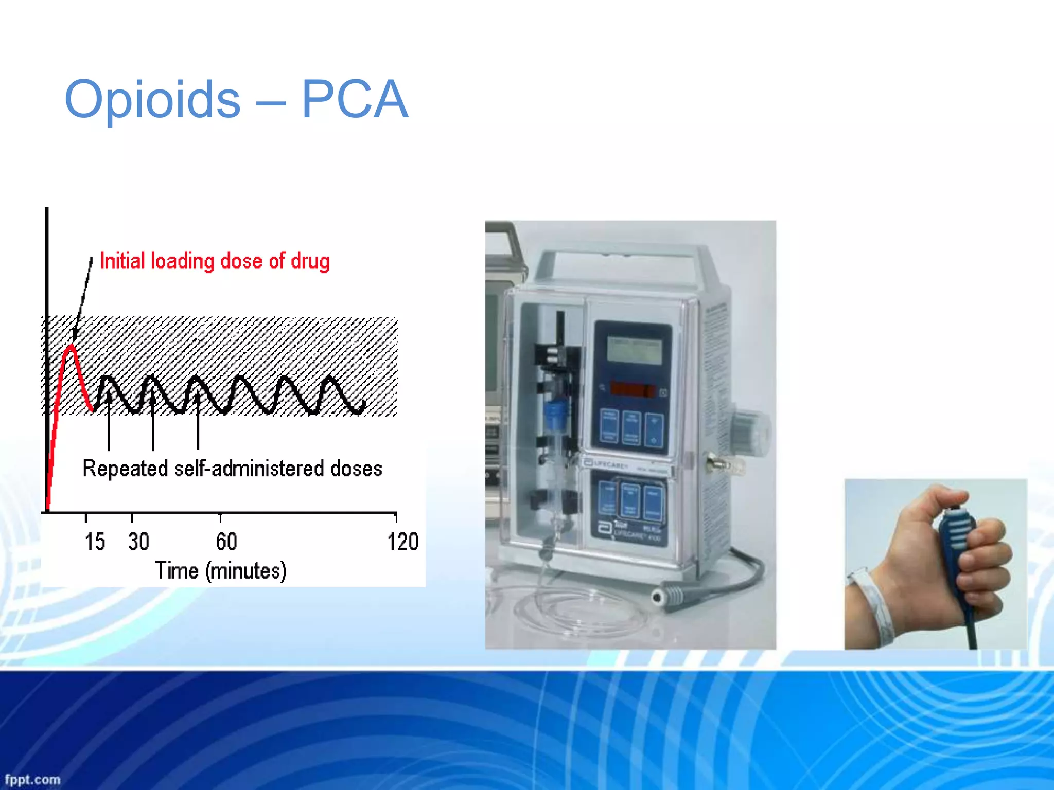 Acute perioperative pain management | PPTX