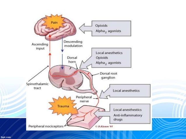 Acute perioperative pain management | PPTX | Pharmaceutical Drugs ...