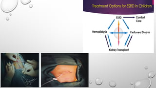 acute peritonitis in continuous ambulatory peritoneal dialysis .pptx