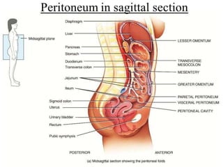 acuteperitonitis SS4 word.docx