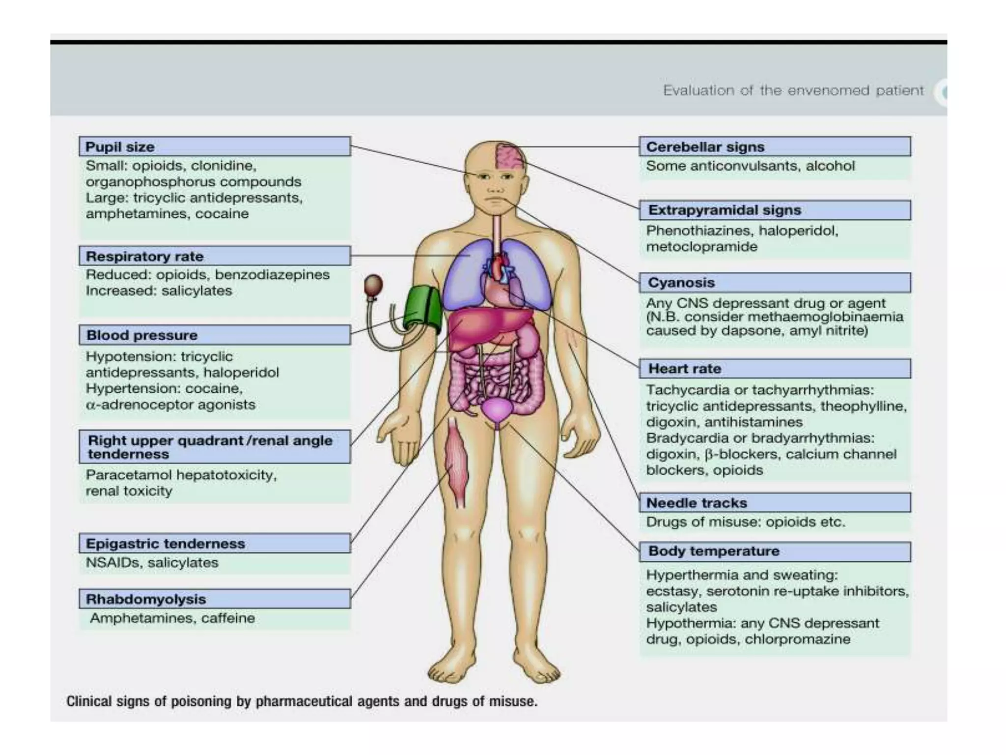 Acute poisoning | PPTX