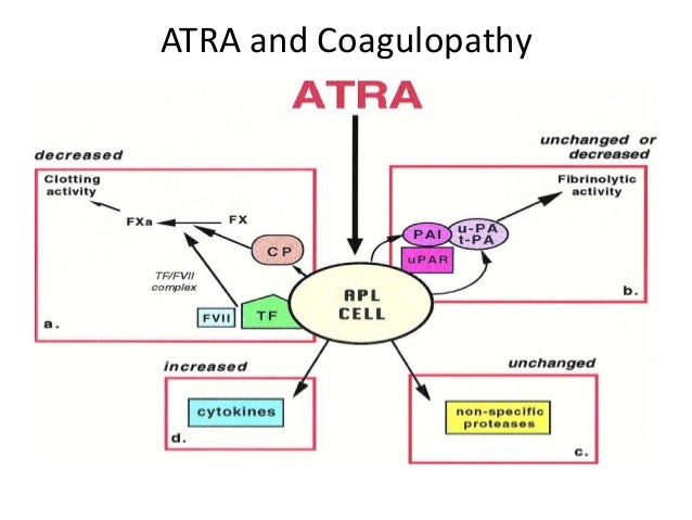 Acute promyelocytic leukemia