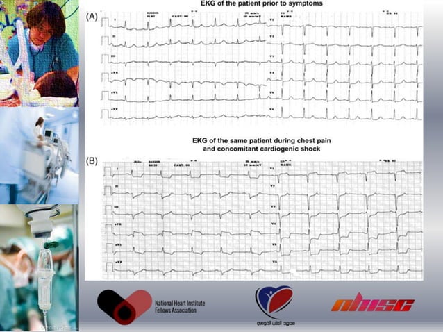 Acute prosthetic valve failure | PPT