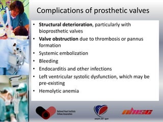 Acute prosthetic valve failure | PPT
