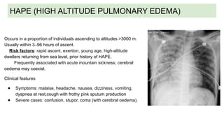 Acute pulmonary edema and its causes .pptx