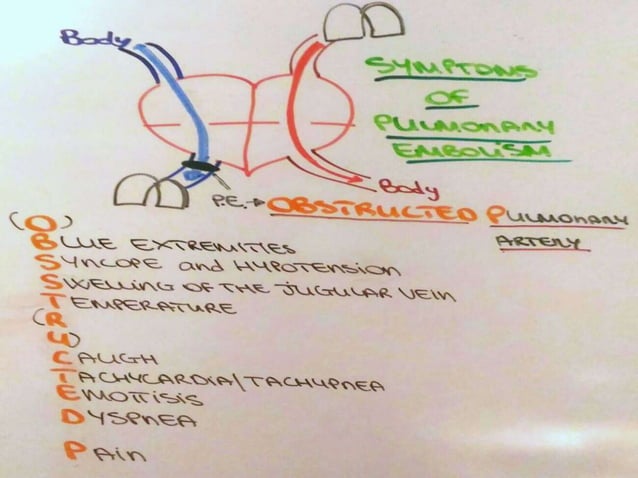 Acute pulmonary embolism and its management. | PPTX