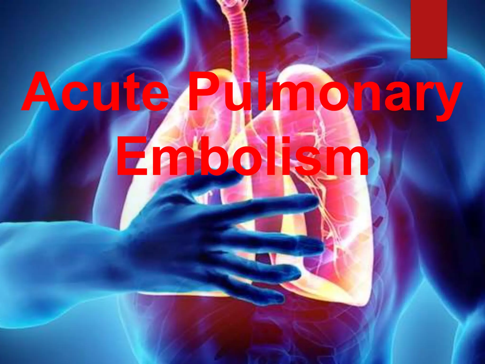Acute Pulmonary Embolism: Introduction, Clinical presentation ...