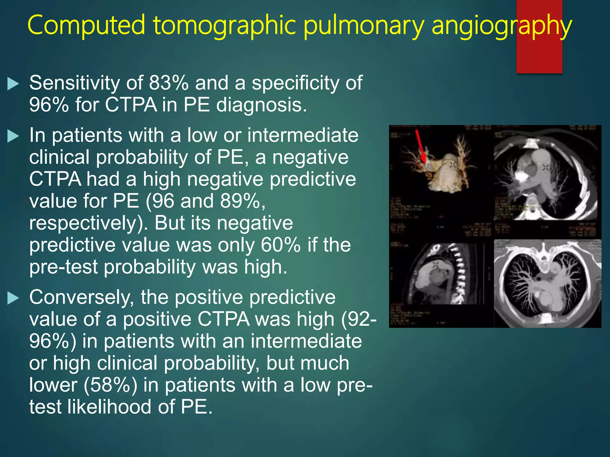 Acute Pulmonary Embolism: Introduction, Clinical presentation ...