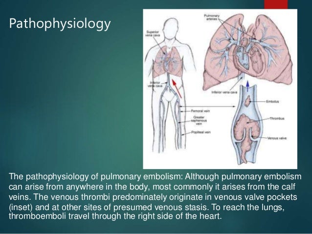 Acute Pulmonary Embolism: Introduction, Clinical presentation, Classi…