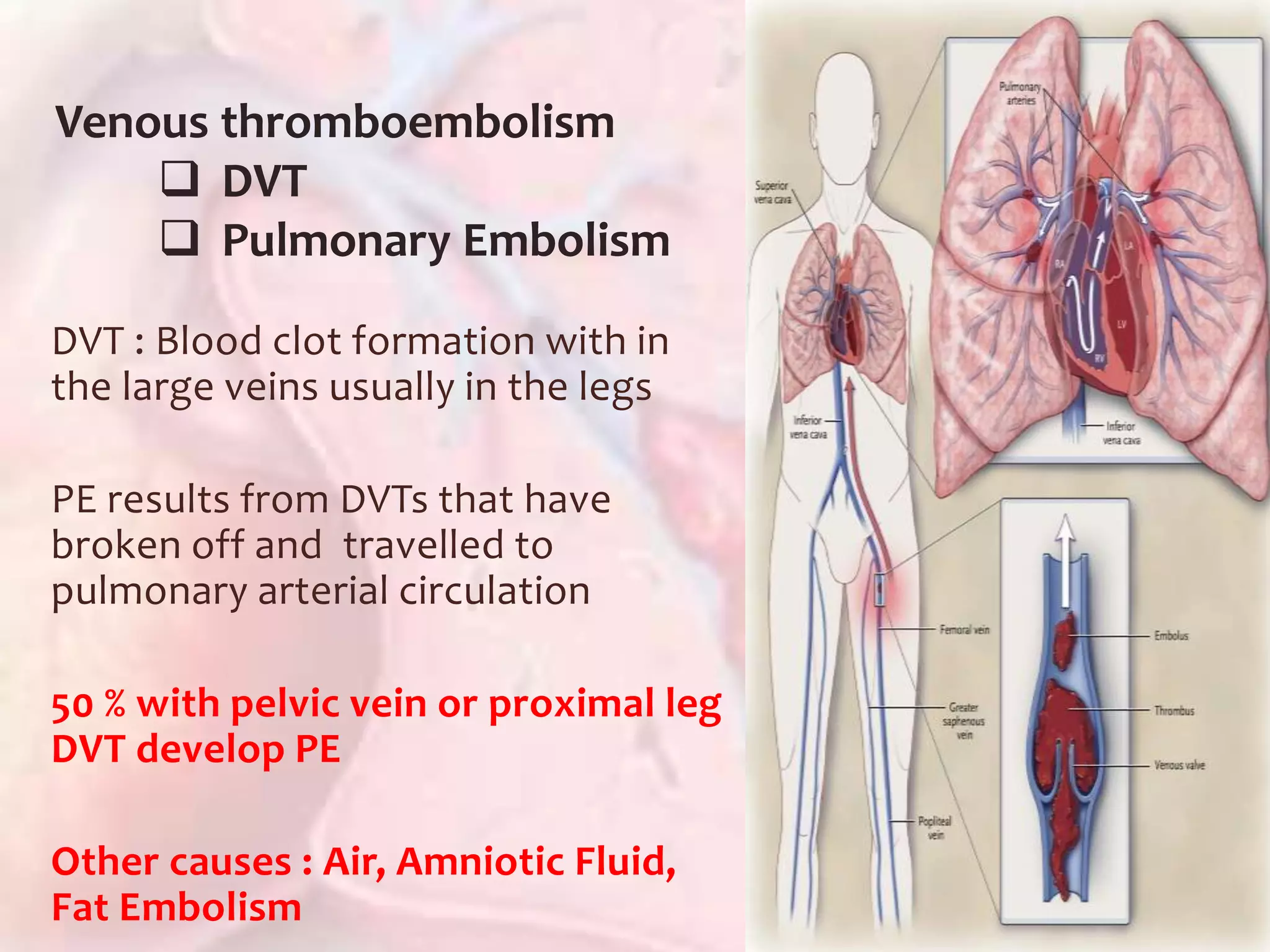Acute Pulmonary Embolism | PPTX