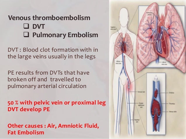 Acute Pulmonary Embolism