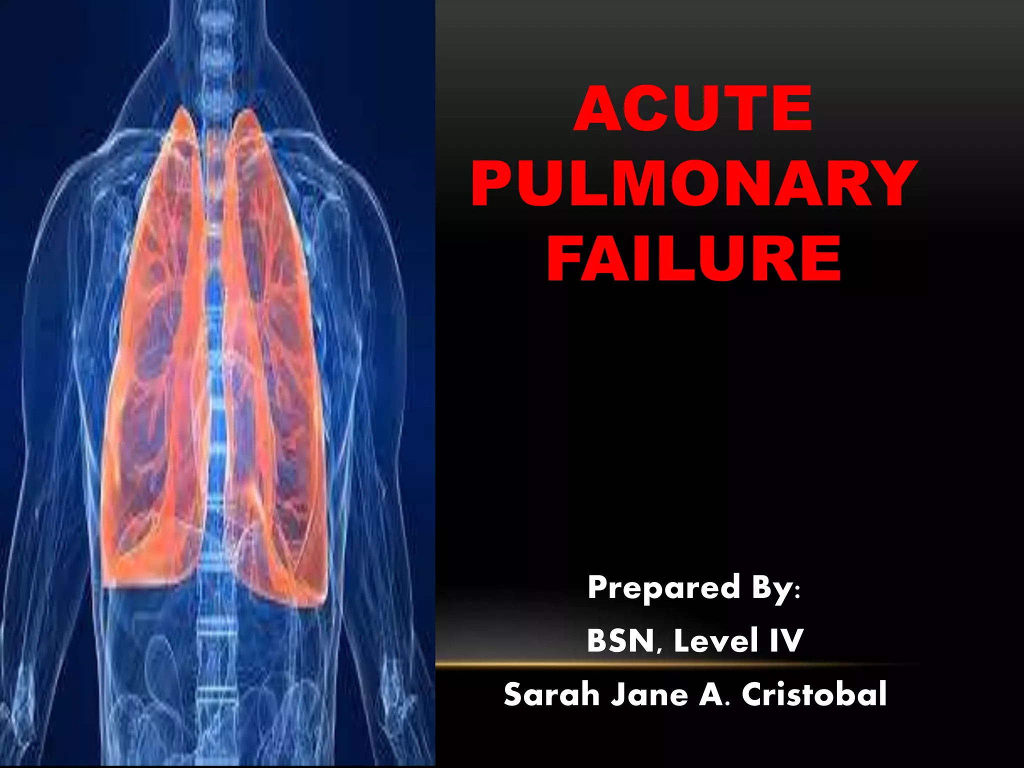 Acute pulmonary failure. | PPT