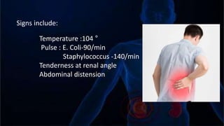 Acute pyelonephritis by N J V S PAVAN | PPT