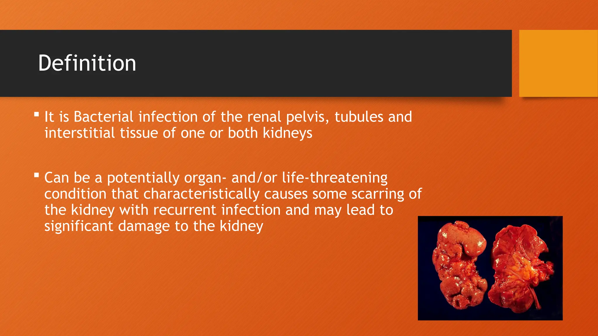 Acute Pyelonephritis an overview approach | PPT