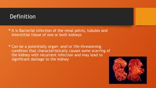 Acute Pyelonephritis an overview approach | PPT