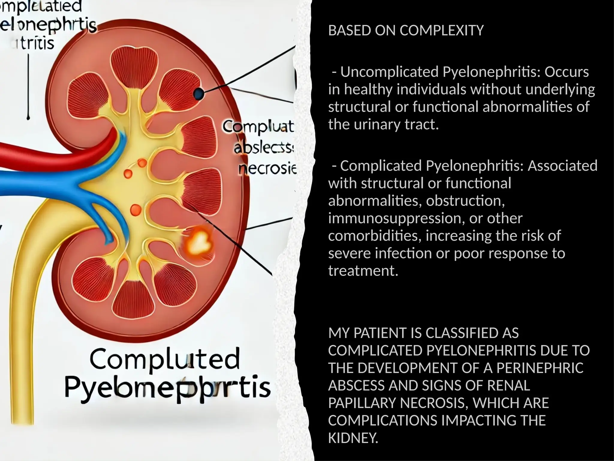 Acute_Pyelonephritis_ Case_History______ | PPTX