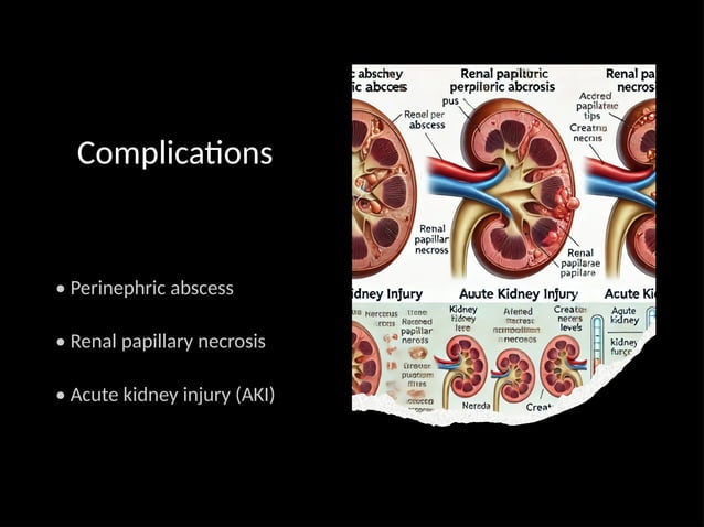 Acute_Pyelonephritis_ Case_History______ | PPT
