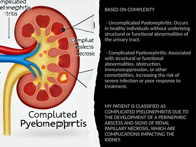 Acute_Pyelonephritis_ Case_History______ | PPT