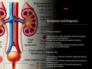Acute_Pyelonephritis_ Case_History______ | PPTX