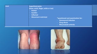 Acute pyogenic arthritis by dr ashutosh | PPTX | Bone and Joint ...