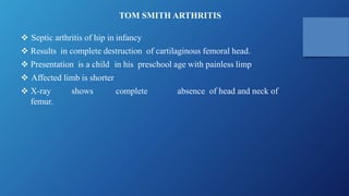 Acute pyogenic arthritis by dr ashutosh | PPTX