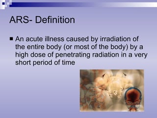 Acute radiation cns syndrome & neurological damage caused by chemical ...