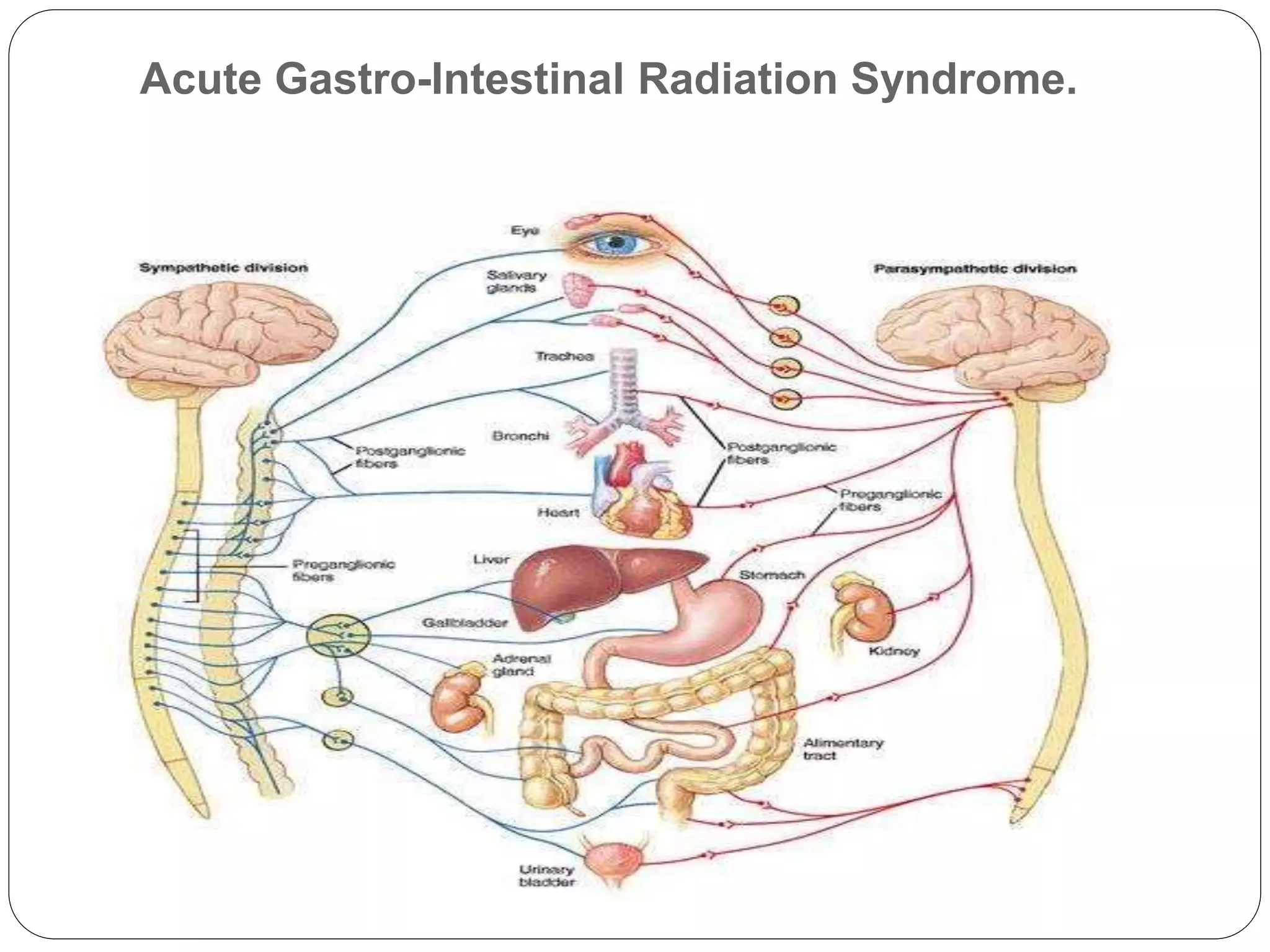 Acute Radiation Gastro-Intestinal syndrome. | PPTX